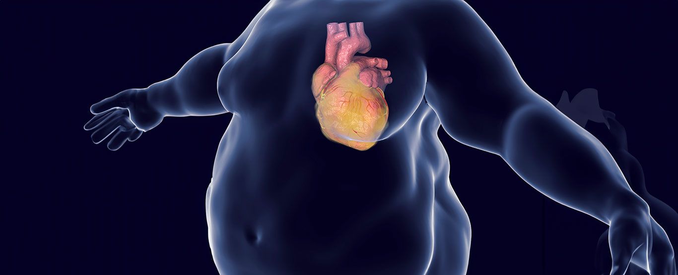 Connecting the Dots Between Weight Loss Treatments and Cardiovascular ...